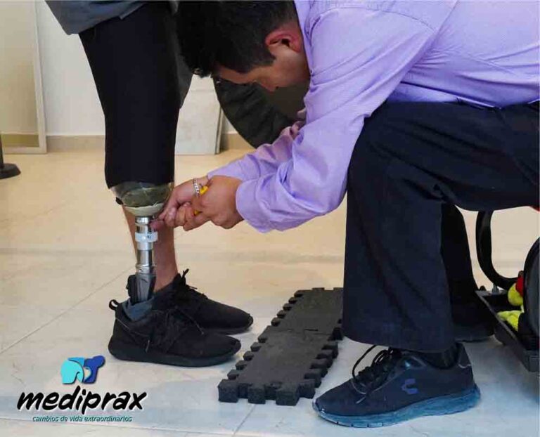 Socket transtibial con diseño PTB - Mediprax